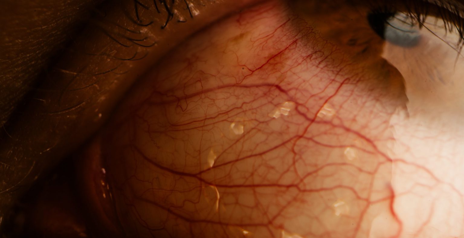 Red Eyes After Weed Use and How to Avoid It l Growing Marijuana Blog